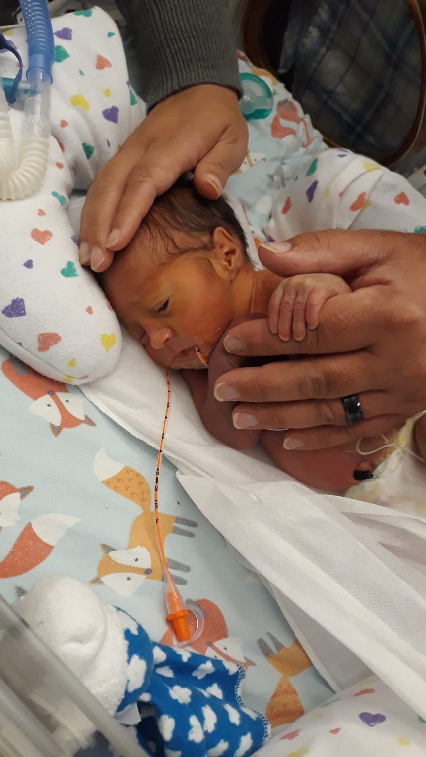 At Last the Parents Get to See His Face--Their Tiny NICU Baby